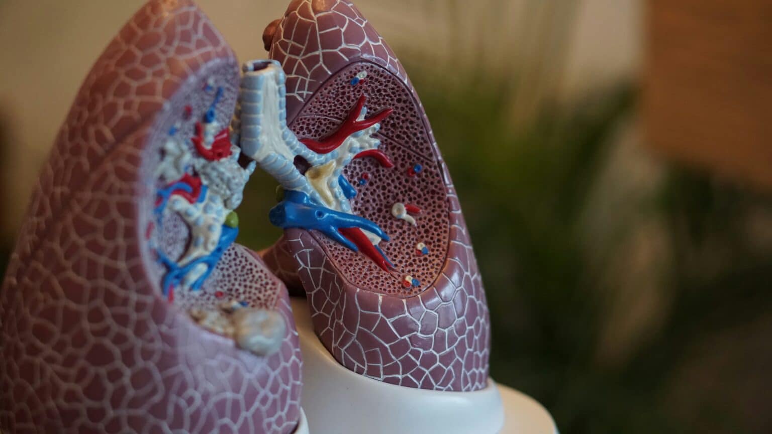 OMS pré-qualifica primeiro teste de diagnóstico da tuberculose | Netfarma